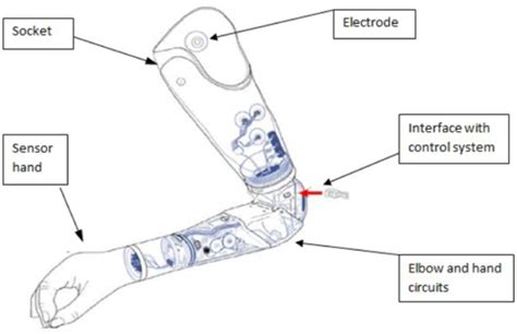 A Review Of Technology Materials And R D Challenges Of Upper Limb Prosthesis For Improved User