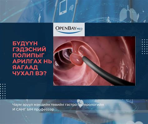 Бүдүүн гэдэсний ургацаг нь цаашид Openbaymed Mongolia Facebook