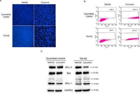 Figure 1 From The Role Of Thrombomodulin In Estrogen Receptor Positive