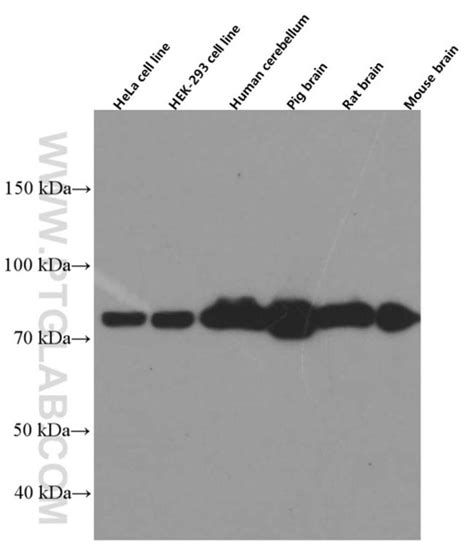 PKC gamma Mouse anti Human Mouse Porcine Rat Clone F B Proteintech μL Unconjugated