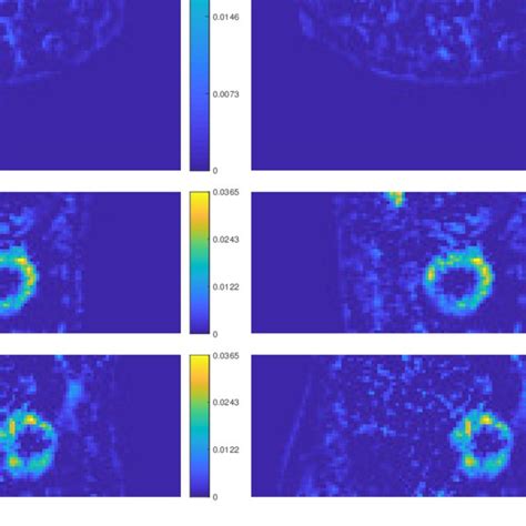 Comparison Of The Standard Patlak Plot And Relative Patlak Plot In The