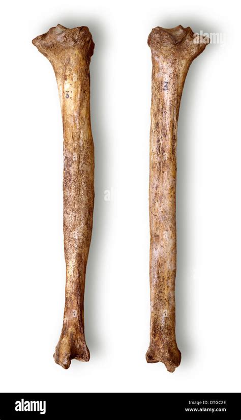 Australopithecus Anamensis Tibia