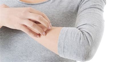 Eksim Numular Penyebab Gejala Diagnosis Dan Pengobatan Pkm Tonrorita