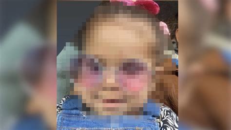 Oglasila Se Majka Male Dunje Podelila Fotografiju Devojčice I Otkrila