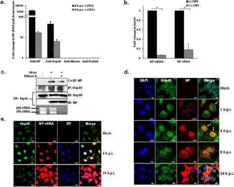 Hsp40 interacts with incoming viral ribonucleoprotein complexes in IAV... | Download Scientific ...