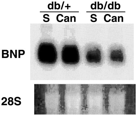 brain natriuretic peptide bnp mrna expression in the heart tissue of