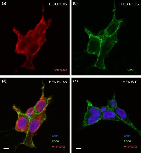 The Subcellular Localization Of Nox5 Nox5 Transfected And