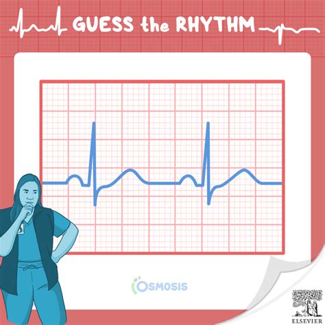 Guess The Rhythm Normal Sinus Rhythm Nsr Osmosis Blog