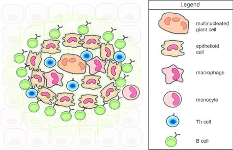 Model Of The Cellular Organization Of A Non Caseating Granuloma