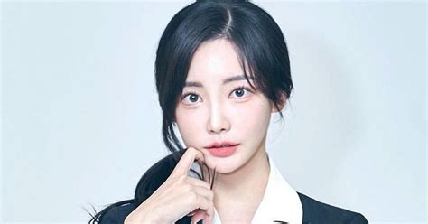 시력 손상 심각하다던데눈 부상 곽민선 아나 근황 전해