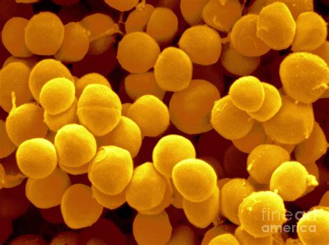 Staphylococcus Saprophyticus