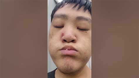 노무현 운지 할것같은 먹방 썩은밥 먹방 Youtube