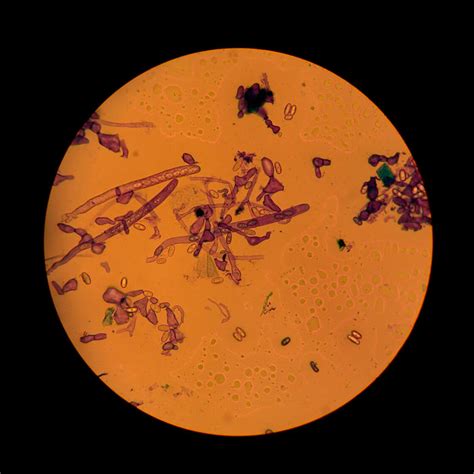 Non Specific Defence System Driver Xelima Records