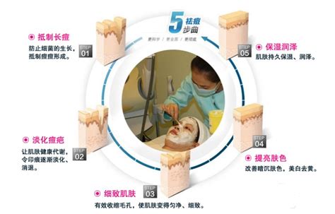 激光祛痘管用吗上海美莱整形医院