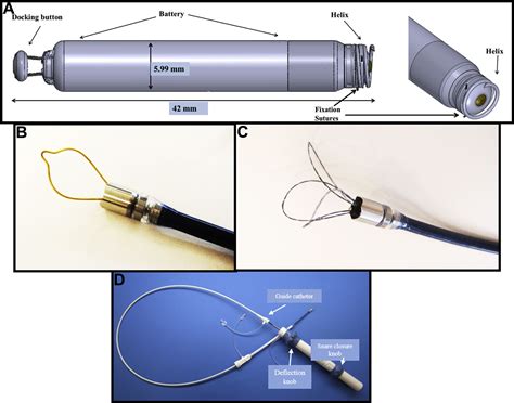 Percutaneous Retrieval Of Implanted Leadless Pacemakers Feasibility At