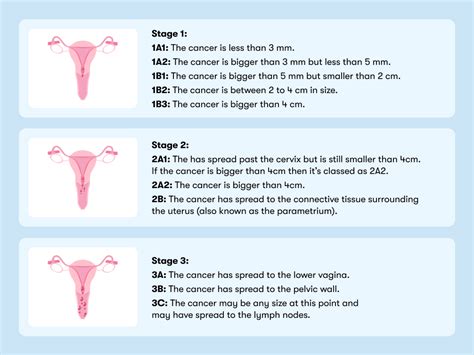 Cervical Cancer Causes Symptoms Stages Prevention