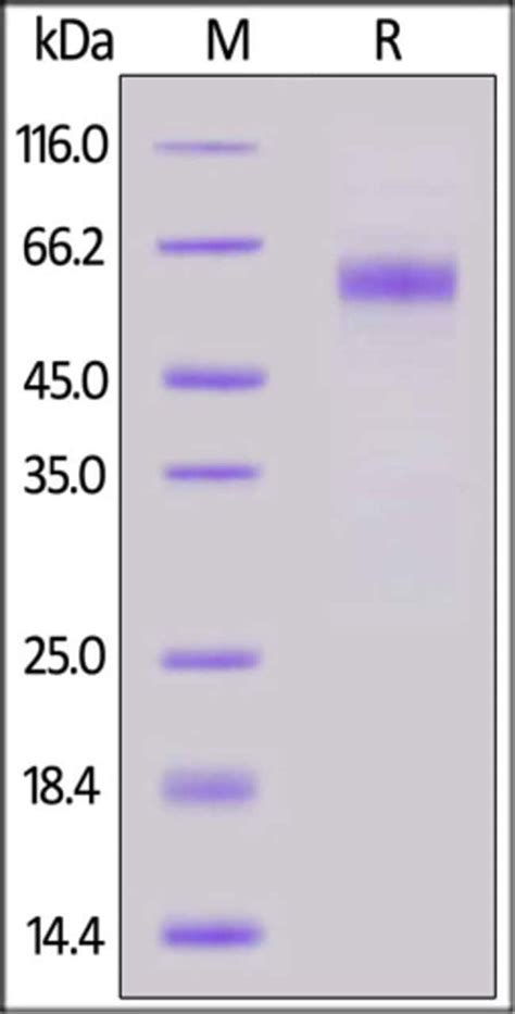 ACROBiosystems ACROBiosystems SARS CoV 2 Nucleocapsid Protein D63G