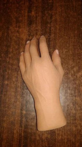Superior Hand Prosthesis At ₹ 90000 Piece Body Part Silicone Prosthesis In Jalandhar Id