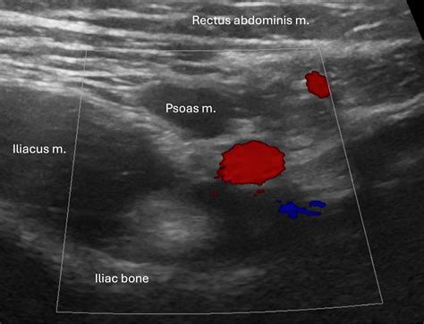 November 2024 Applied Radiology