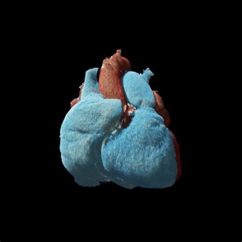 Stanford 3d And Quantitative Imaging Laboratory On Linkedin Healthcare