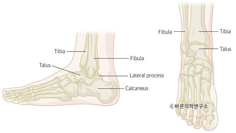 거골 골절fracture Of The Talus Metamedic