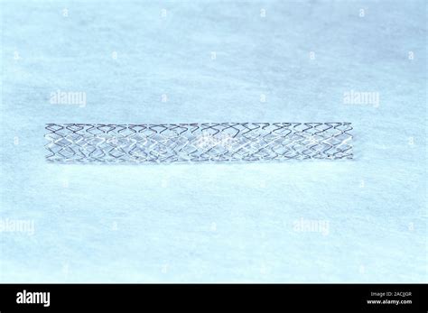 Vaso sanguíneo stent Los stents son tubos de malla de alambre que se