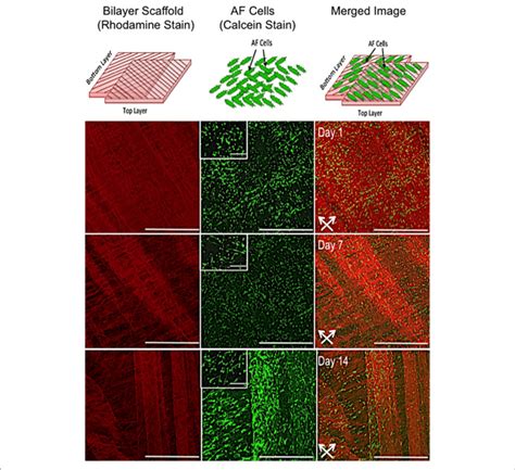 In Vitro Response Of Annulus Fibrosus Af Cells On Pclplla