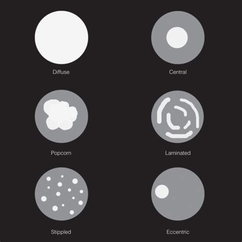 Nodules And Masses Clinical Tree