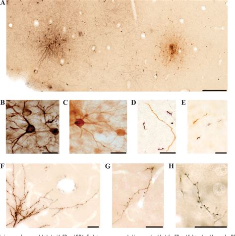 Figure 1 From Functional Selectivity Of Interhemispheric Connections In Cat Visual Cortex