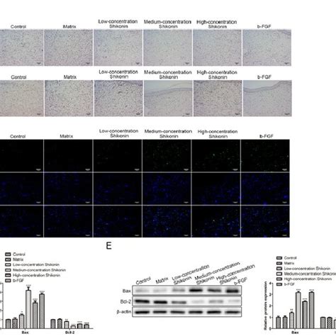 Effects Of Shikonin On Scar Fibroblast Proliferation And Apoptosis