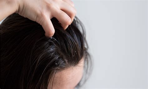 5 Reasons Your Scalp Itches And How To Get Relief 3p Cell