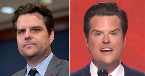 Matt Gaetzs Physical Appearance Sparks Concern After Rnc Speech