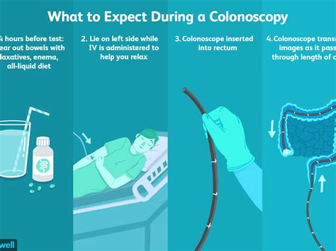 Colonoscopy Age