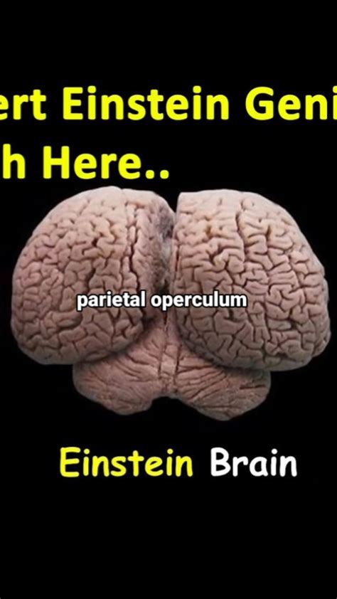 Albert Einstein Brain Vs Normal Brain Albert Einstein Brain Vs Normal Brain