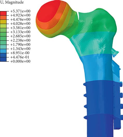 Displacement Diagram Of Different Types Of Reduction A Anatomical Download Scientific
