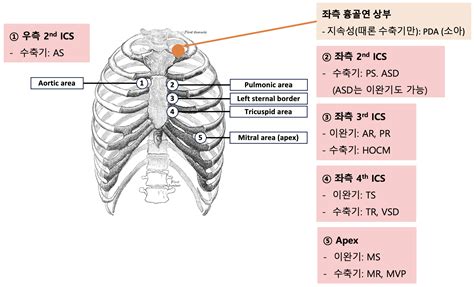 판막질환 개요 메디톡
