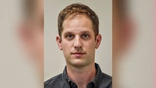 後頭部結合の双生児分離手術が成功 イスラエル CNN co jp
