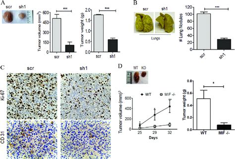 Mif Downregulation Reduces Tnbc Growth And Metastasis A Mif Knockdown