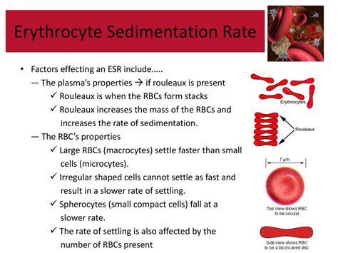 Performing A Erythrocyte Sedimentation Rate Ppt Download