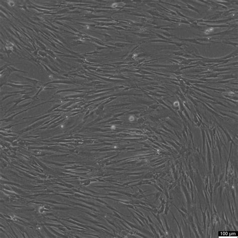 Ccd 18lu Cells