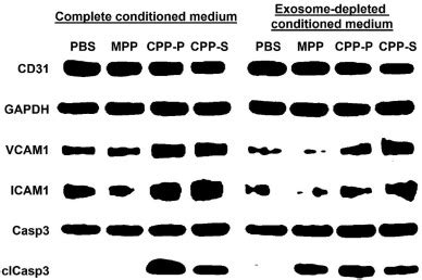 Conditioned Medium From Calciprotein Particle Treated Endothelial Cells