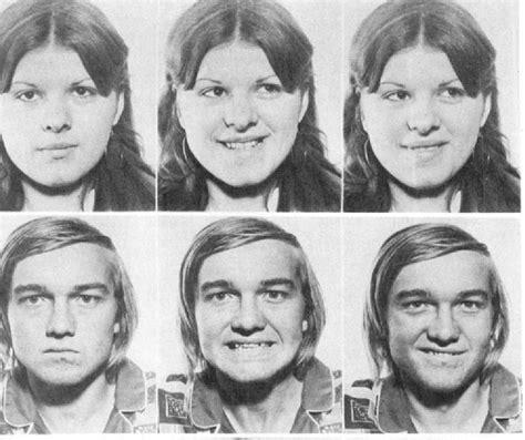 30 Facts About Facial Asymmetry Temporal Seizures