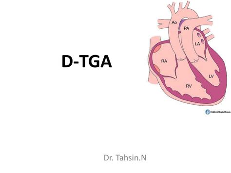 PPT D TGA PowerPoint Presentation Free Download ID 839924