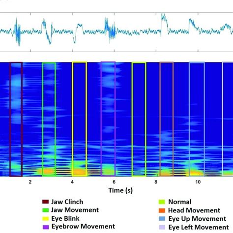 Pdf Single Channel Eeg Artifact Identification Using Two Dimensional