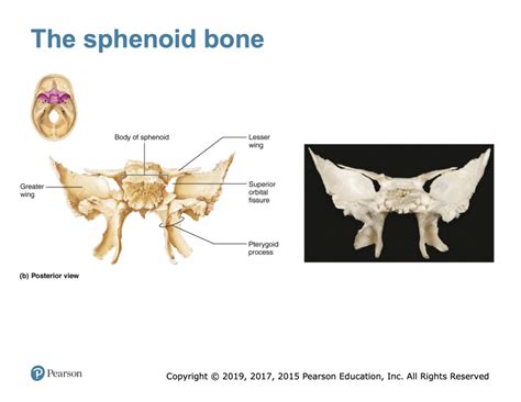 Exercise 6 The Sphenoid Bone Posterior View Diagram Quizlet