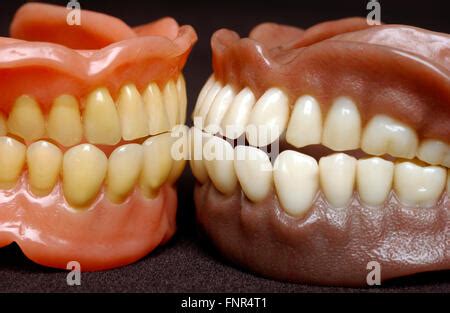 Two Sets Of Full Dentures Dentures Or False Teeth Are Made From An