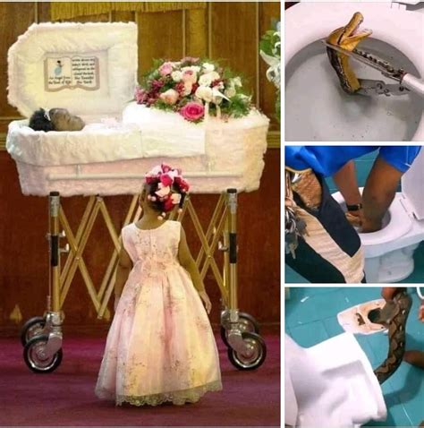 A Young Girl Said Goodbye To Her Twin Sister Who Snake Bit