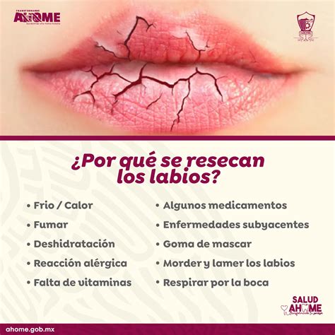 Por Qué Se Resecan Los Labios Escuela De Higiene Dental Higienista