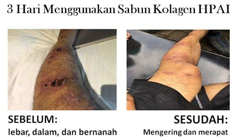 Toko Herbal Online Terpercaya Di Bandung Agen Resmi Herbal HPAI Jual Sabun Kolagen HPAI