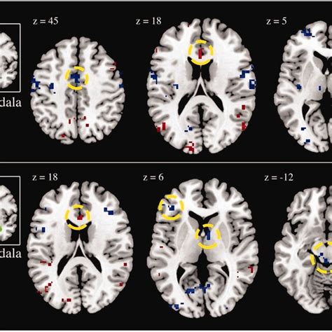 Effects Of Sleep Duration On Resting State Functional Connectivity Of Download Scientific